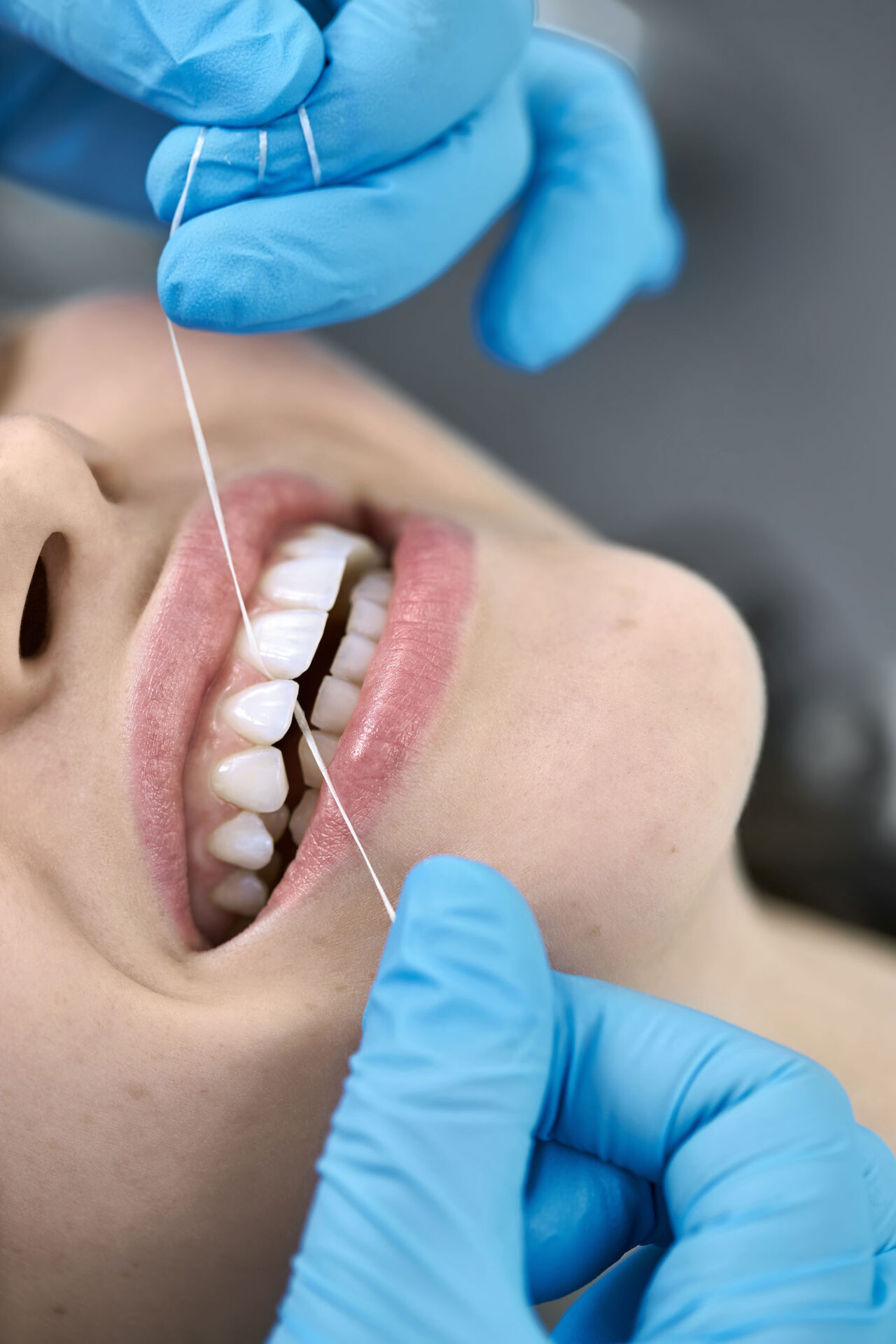 Oral Hygiene | Expressions Dental Practice